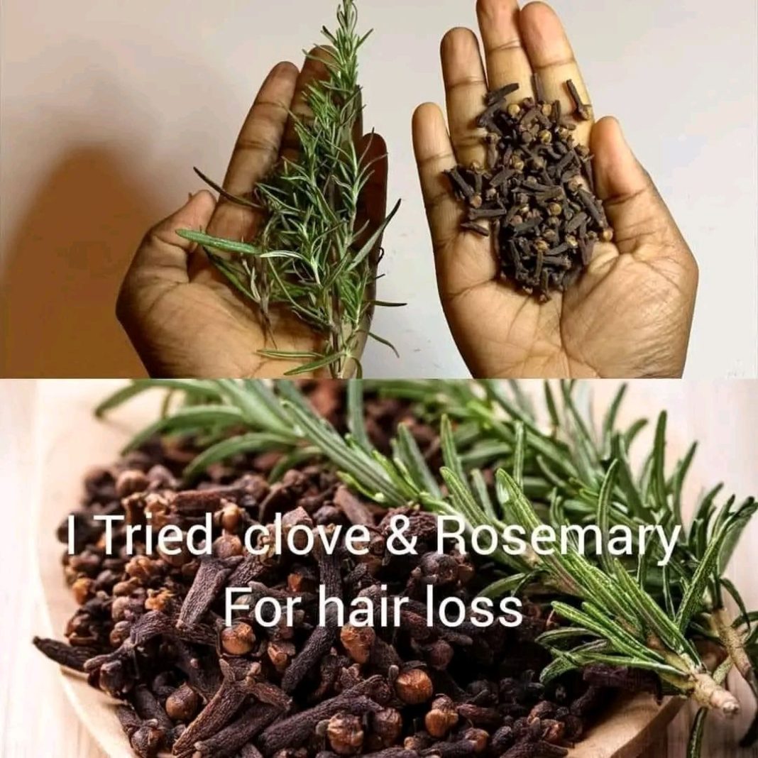 How to Make Clove + Rosemary Oil for Faster Hair Growth in 3 Easy Steps ...