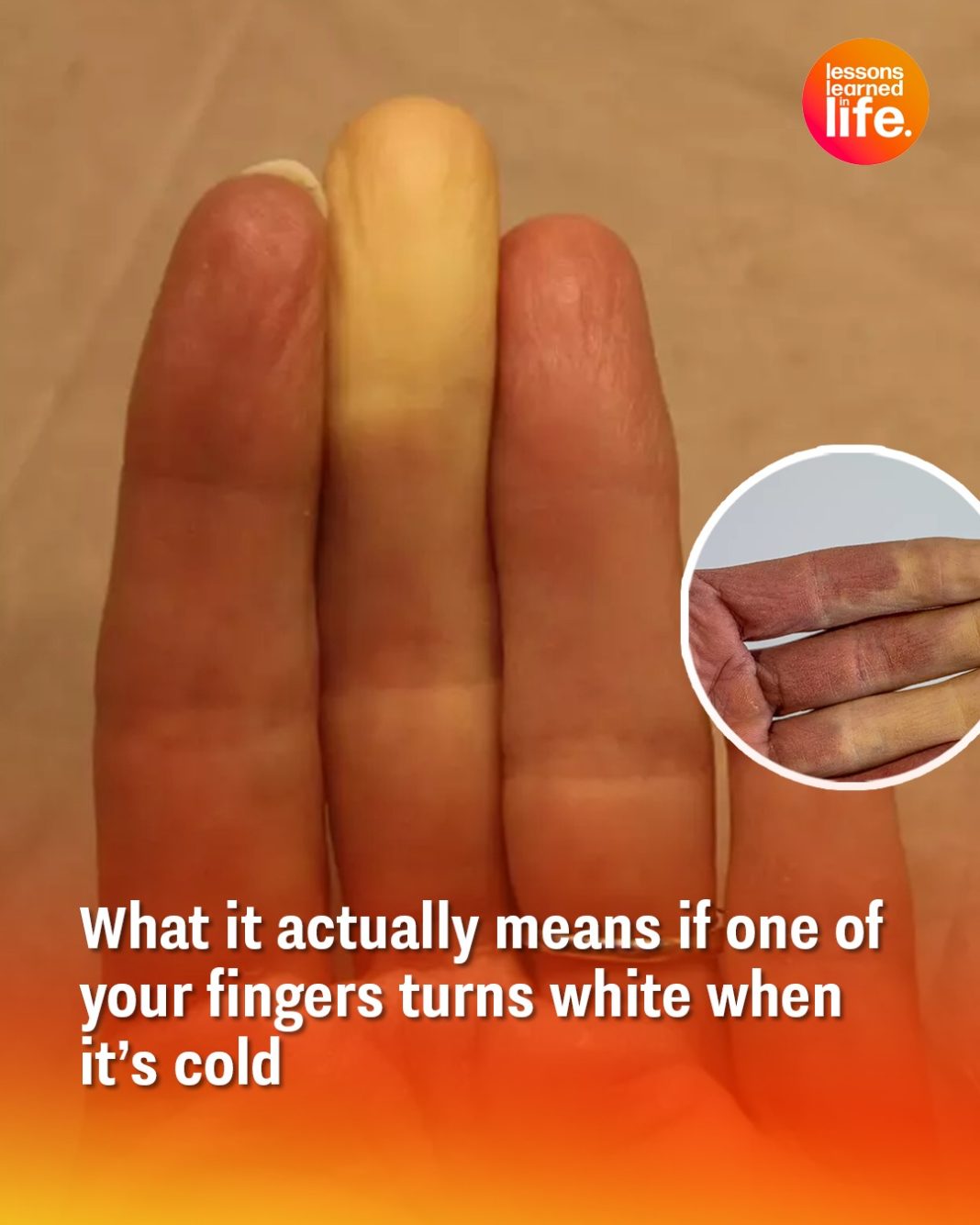 What it actually means if one of your fingers turns white in the cold ...