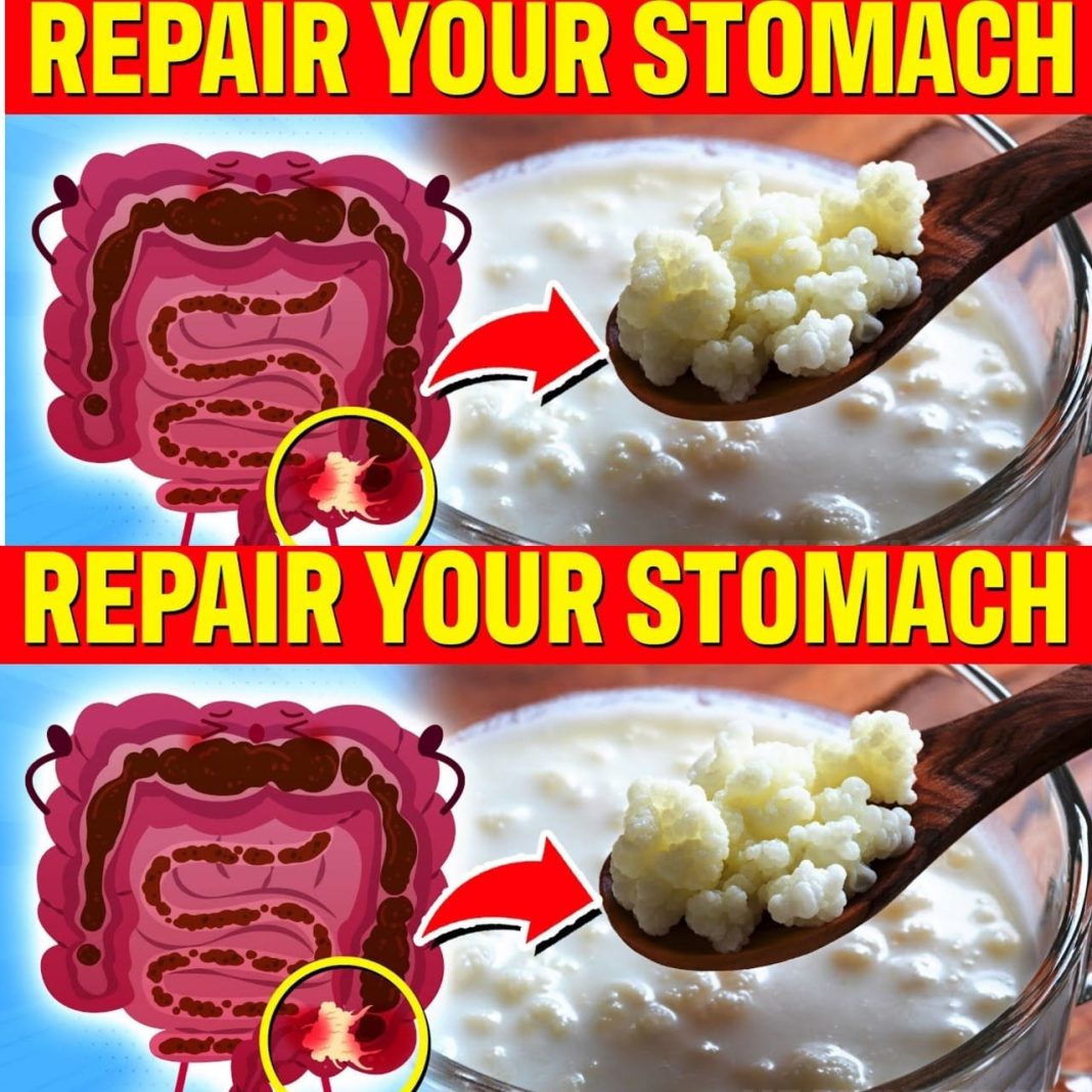 EAT These 10 POWERFUL Foods to Heal Your Gut and Repair Your Stomach ...