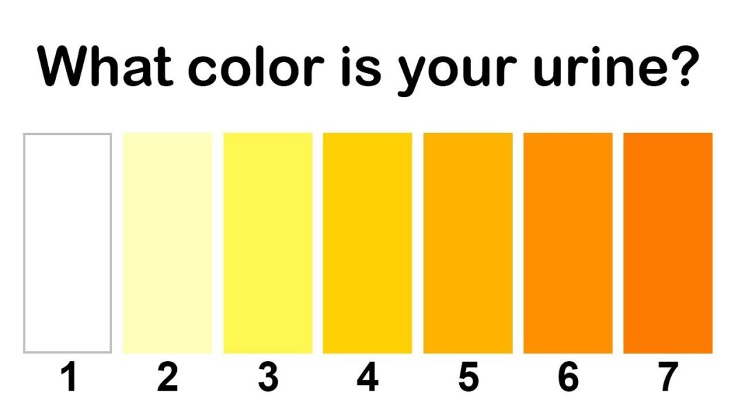 What You Should Know: The Color of Your Urine Determines Your Kidney ...