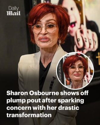 Sharon Osbourne, 72, shows off her plump pout as she attends husband ...