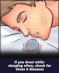 10 Reasons You’re Drooling While You Sleep and What It Could Mean ...