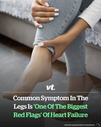 Common symptom in the legs is ‘one of the biggest red flags’ of heart ...