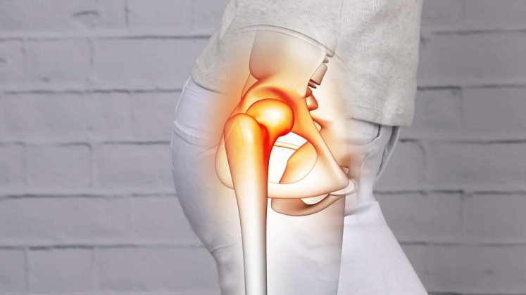 Hip pain: what does it mean? | Najukusnije vijesti