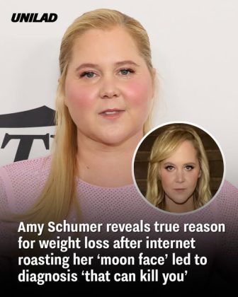 Amy Schumer reveals true reason for weight loss after internet roasting ...
