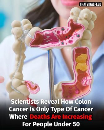 Scientists Explain Why Colon Cancer Is The Only Cancer With Rising ...