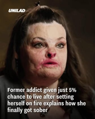 Former addict given just 5% chance to live after setting herself on ...